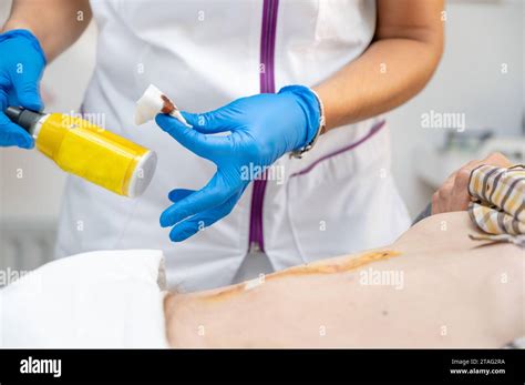 Wound Dressing Clinic At Windy Lawson Blog