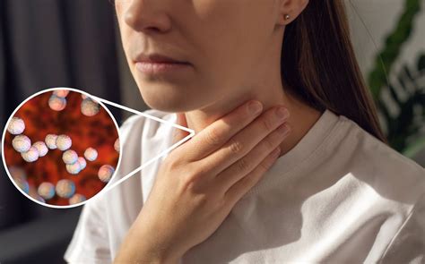 Qué Es La Streptococcus Pyogenes Se Reportan 93 Muertes En Argentina Por Infección