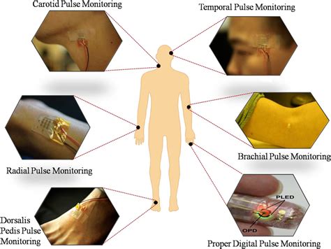 Representative Examples Of Wearable Sensors For Pulse Monitoring Representative Examples Of Wearable Sensors For Pulse Monitoring
