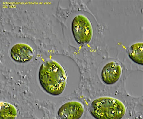 Actinosphaerium Eichhornii Var Viride Real Micro Life