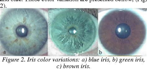 Figure 2 From Medical Diagnosis System Based On Iris Analysis