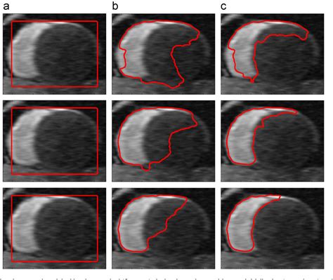figure 1 from level set image segmentation with bayesian analysis