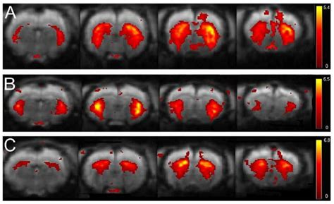 Striatal Functional Connectivity Maps Resulting From 15 And 40