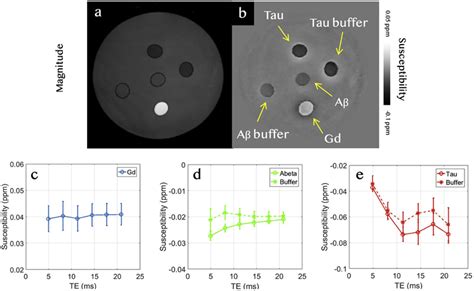 T2 Weighted Magnitude At Te Of 491 Ms A And Susceptibility Map Download Scientific Diagram T2 Weighted Magnitude At Te Of 491 Ms A And Susceptibility Map Download Scientific Diagram