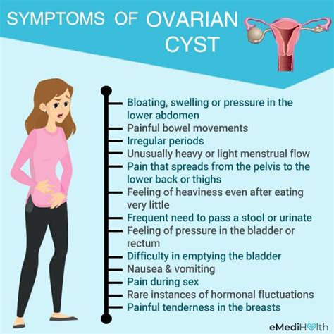 Ovarian Cysts 101 Causes Signs Treatment Myths Artofit