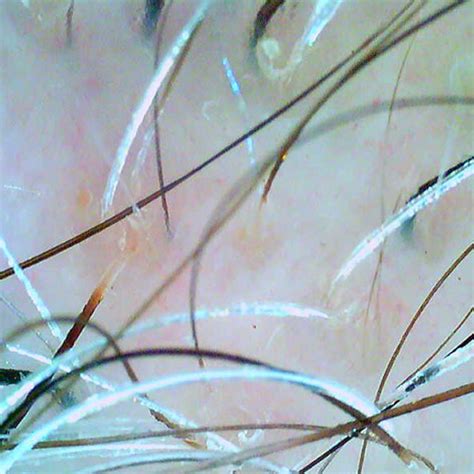 protocol anomalies treatments at jean paul mynè salon