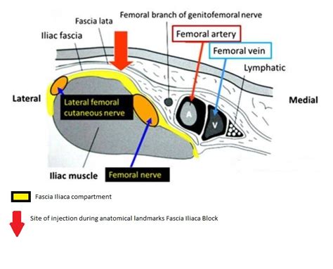 Fascia Iliaca Block Fib In Elderly Patients Outside The Operating