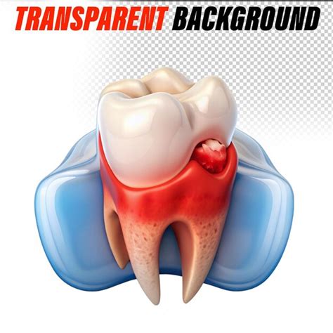 Premium Psd Internal And External Tooth Set