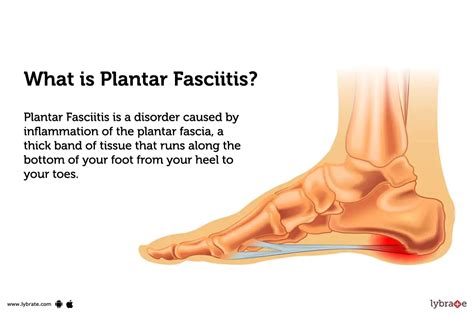 Plantar Wart Causes Symptoms Treatment And Cost