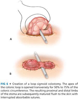 Image01254 Jpeg Abdominal Key