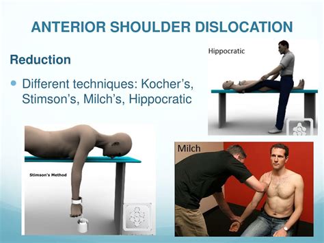 Ppt Acute Joint Dislocation Powerpoint Presentation Free Download