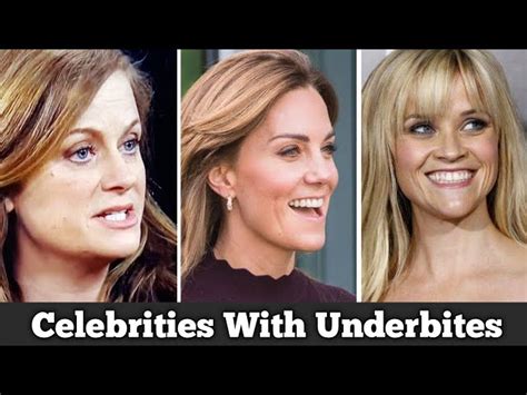 Celebrities With Underbites Celebrities With An Underbite Tiktok