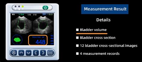 How To Choose The Right Bladder Scanner Comprehensive Guide BladGo