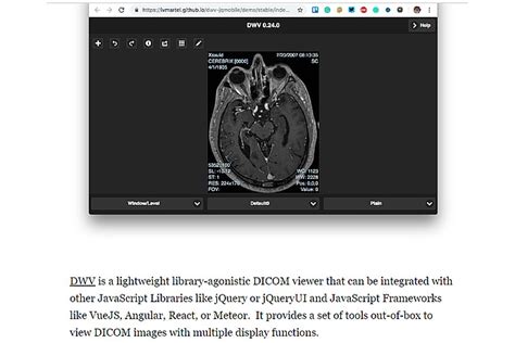 Idb Dicom Web Viewer