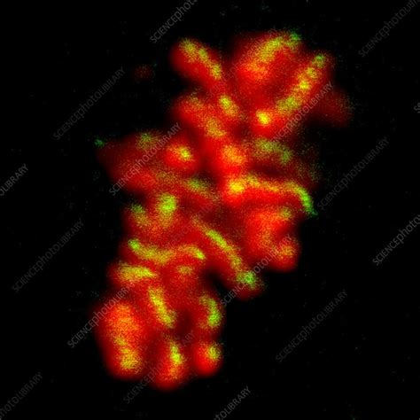 Human Chromosomes In Metaphase Light Micrograph Stock Image C056