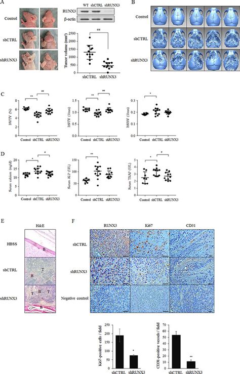 Loss Of Runx3 Expression Inhibits Bone Invasion Of Oral Squamous Cell