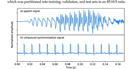 Ultrasound Synchronization Signal The Rising Edge Of The Pulses