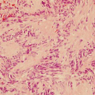 Amianthoid Fibers Hematoxylin Eosin Download Scientific Diagram