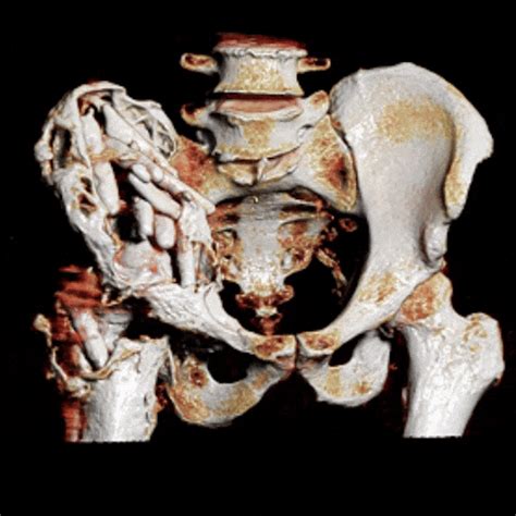 What Is 3d Imaging 3d And Quantitative Imaging Laboratory