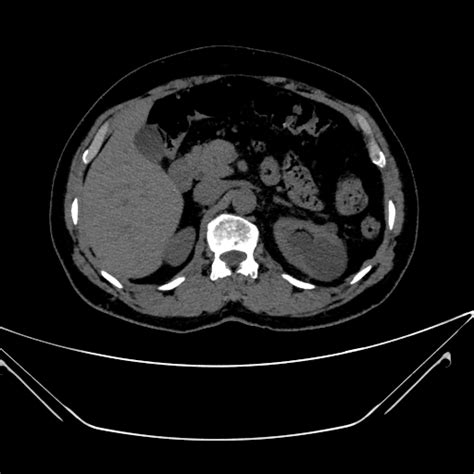 Faster Rcnn Object Detection Dataset By Businnes