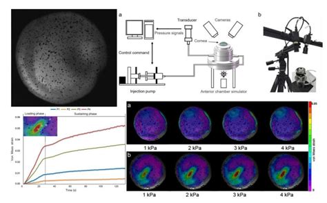Medicine In Novel Technology And Devices On Linkedin Full Field Strain