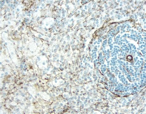 Dab Staining Dab Peroxidase Substrate Kit Vector Labs