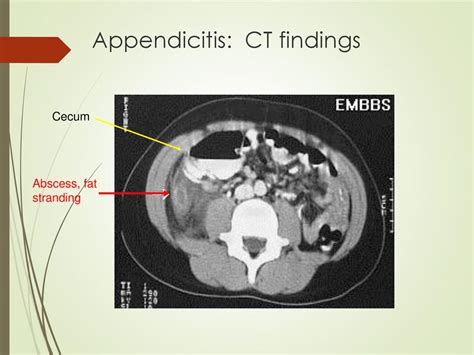 Hossam Hassan Department Of Emergency Medicine Ppt Download