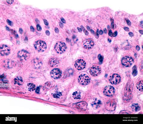 Diplotene