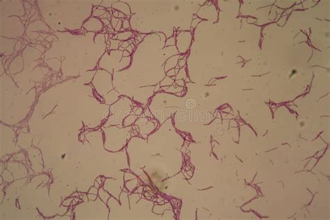 Bacillus Anthracis Anthrax 200x Stock Image Image Of Bacillus Germs 191661449