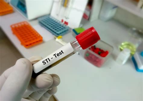 Premium Photo Blood Sample For STI Or Sexually Transmitted Infection Test