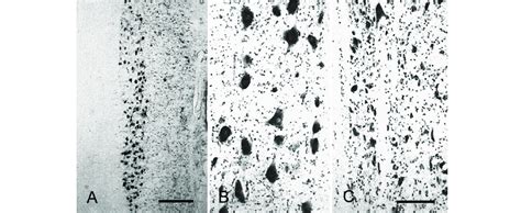 Photomicrographs Showing Motor Neurons In Treated Cats A An Download Scientific Diagram