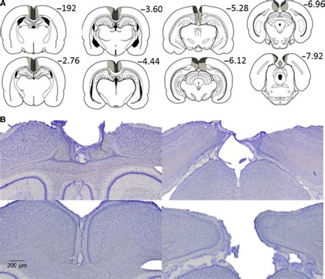 The Retrosplenial Cortex And Object Recency Memory In The Rat Pmc