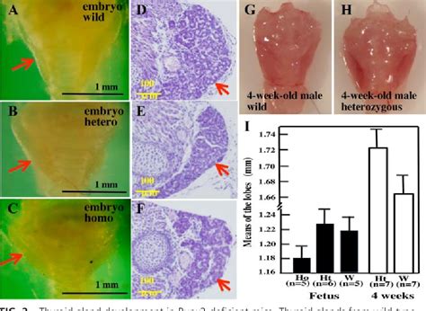 Figure 2 From Runx2 Deficiency In Mice Causes Decreased Thyroglobulin