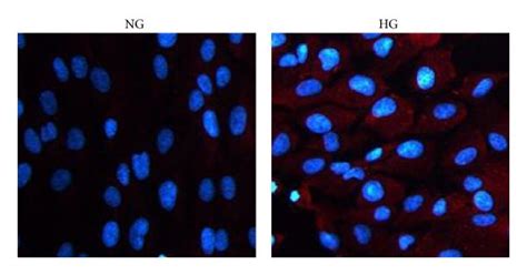 Immunofluorescence Evaluation Of Fibronectin Collagen Iv And Laminin