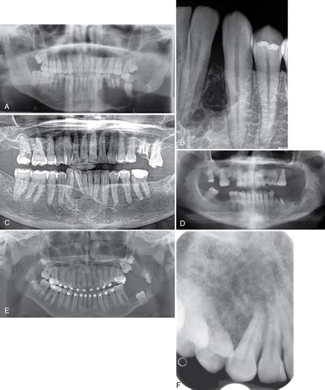 Odontogenic Tumors Clinical Tree