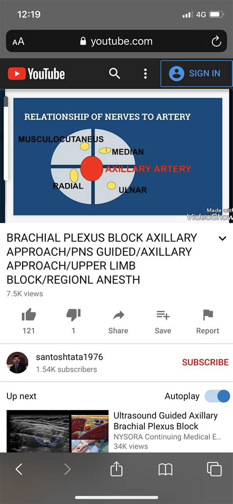 Pin By Deepika Mahajan On Brachial Plexus Block Plexus Products