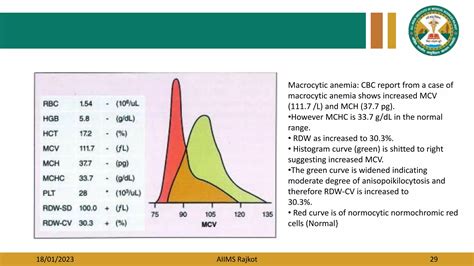 Macrocytic Anemiapptx