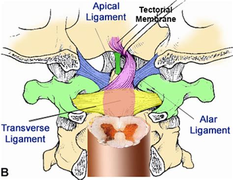Occipitocervical Instability Spine Orthobullets