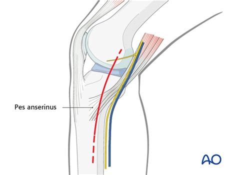 Proximal Tibia