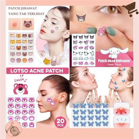 Jual [original] Stiker Jerawat Acne Patch Hydrocolloid Acne Pimple Patch Isi 36pcs Shopee