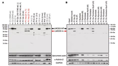 Most Lmod3 Mutations Abolish Lmod3 Protein Expression Western Blots
