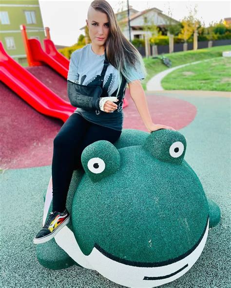 Nice Lats Cast And Sling For This Girl Arm Cast It Cast Orthopedic Brace