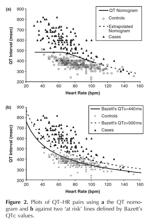 QT Interval LITFL ECG Library Basics