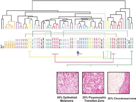 Evolving Molecular Portraits Of Metastatic Melanoma Eisen S Download Scientific Diagram