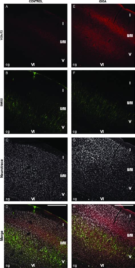 Distribution Of Vglut2 In The Different Motor Cortex M1 Layers Of The Download Scientific