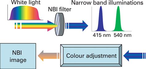 High Resolution Narrow Band Imaging Endoscopy Gut
