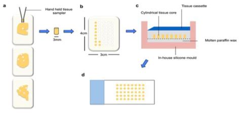 High Throughput Tissue Microarray Neurodegenerative Pathology Research