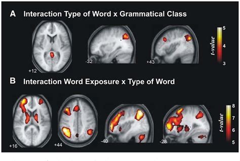 Figure 2 From Neural Differences In The Mapping Of Verb And Noun
