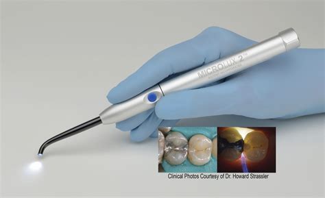 Dental Caries Detector At Steven Watt Blog