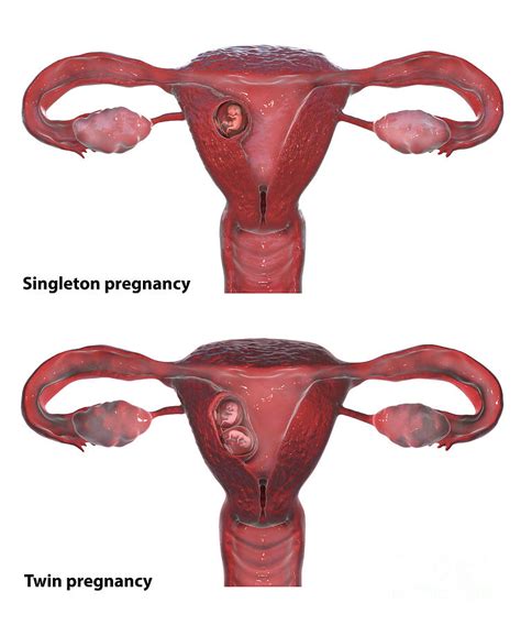 Singleton And Multiple Pregnancy Photograph By Kateryna Konscience